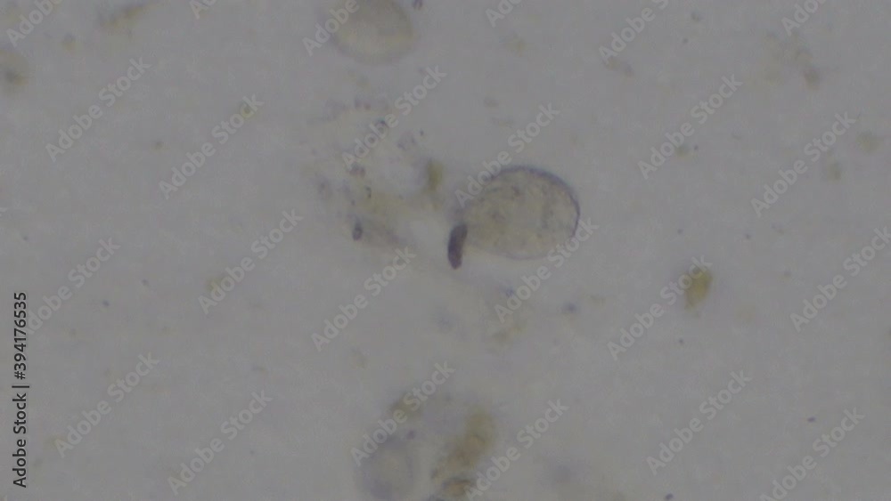 Microscopy of protozoa microorganisms in the water sample, showing ...
