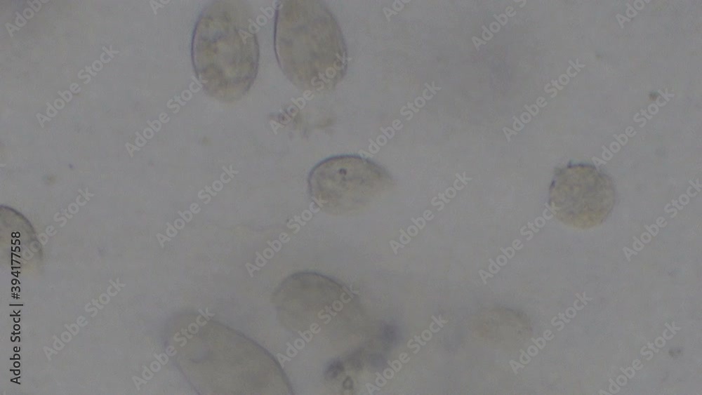 Microscopy of protozoa microorganisms in the water sample, showing ...