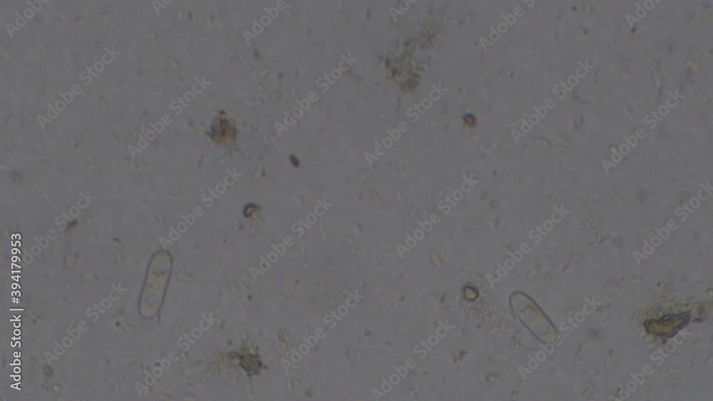 Microscopy of Coccidia organisms in a rabbit feces. Parasite (Eimeria ...