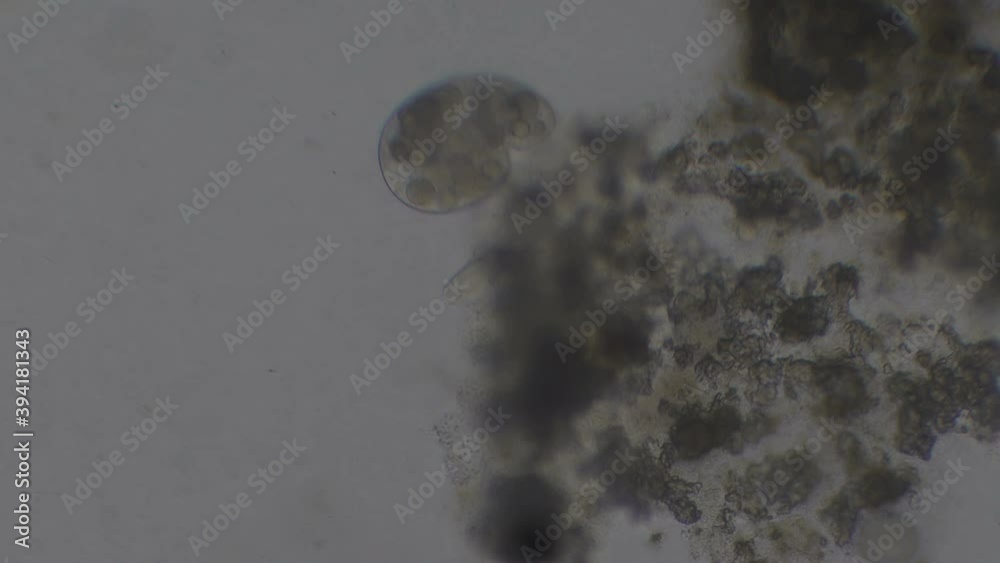 Microscopy of protozoa microorganisms in the water sample, showing ...