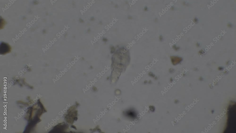 Microscopy of protozoa microorganisms in the water sample, showing ...