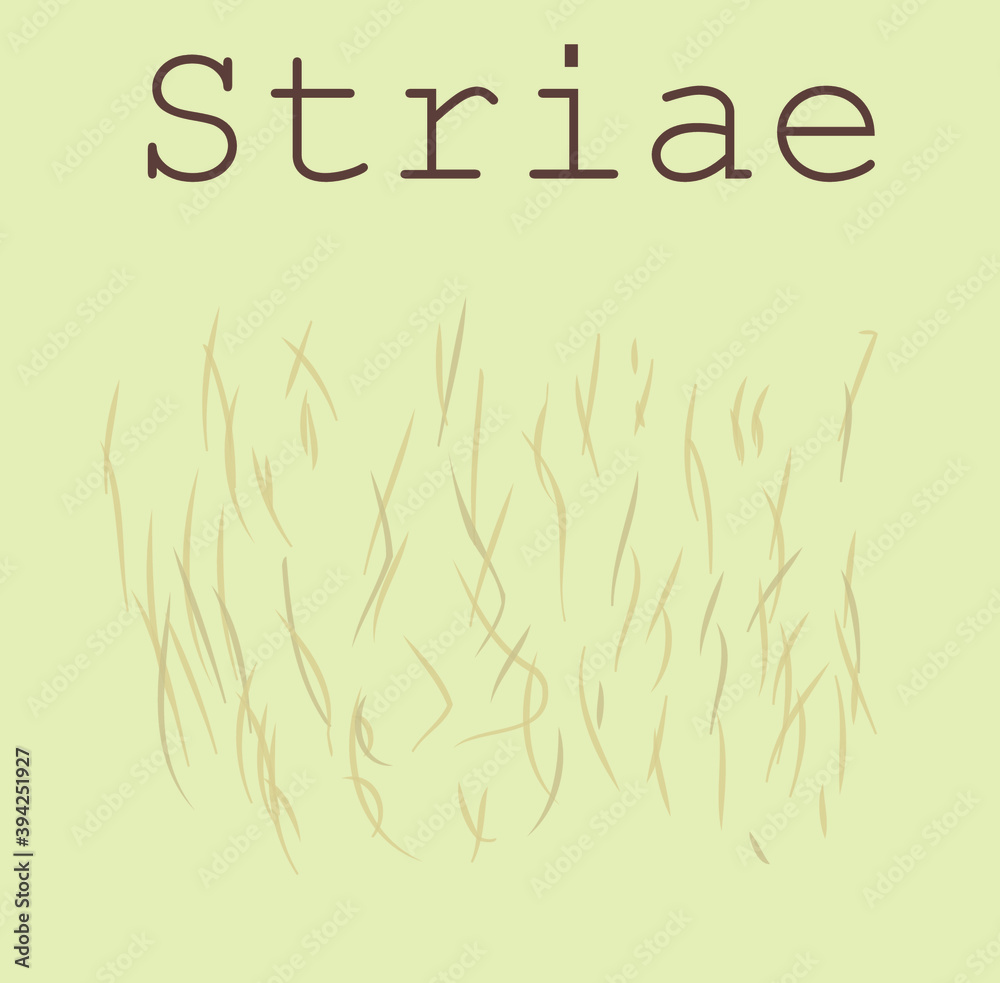 striae. abstract image of stretch marks on the skin. stomach after ...