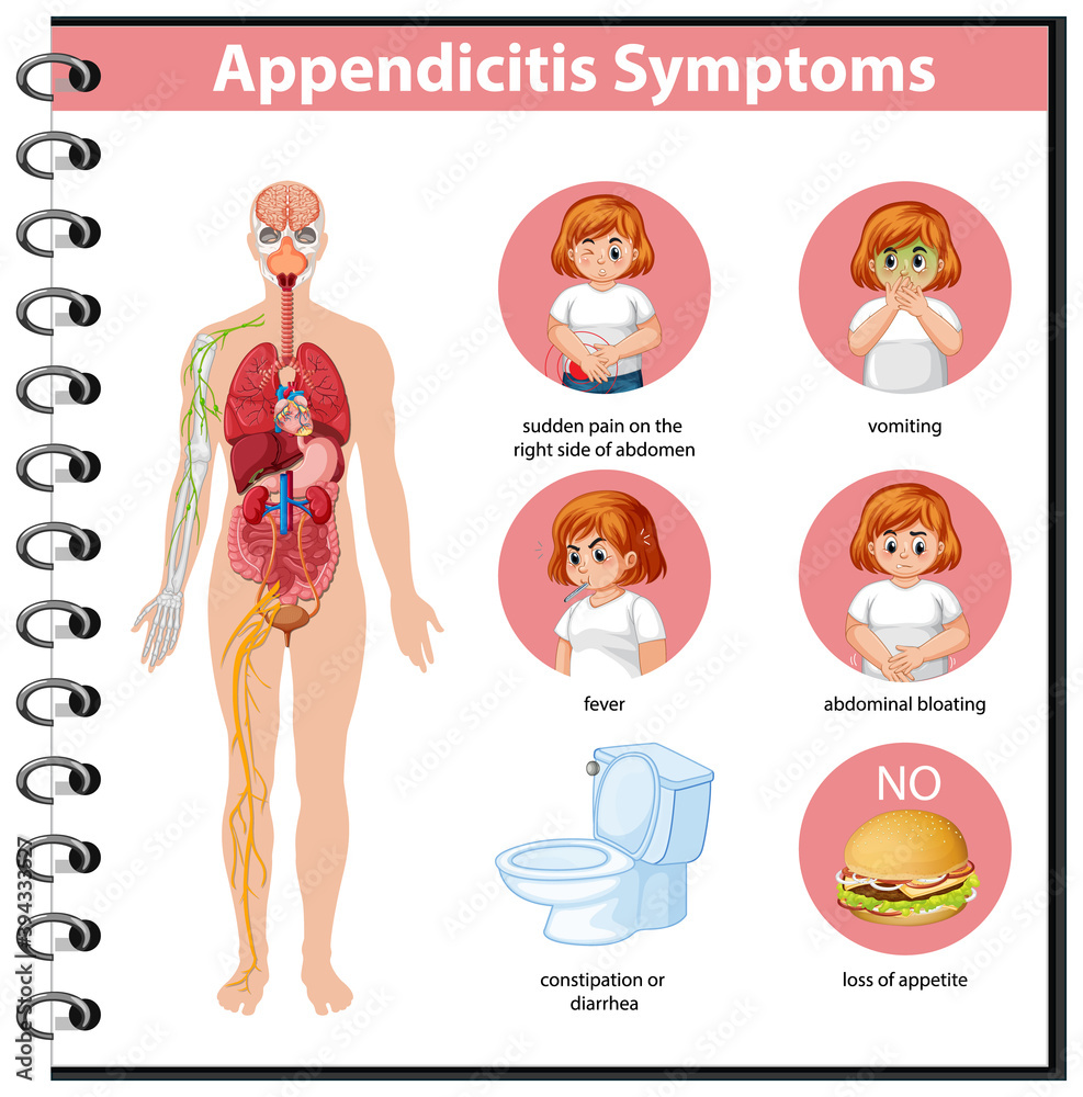 Appendicitis Symptoms information infographic Stock Vector | Adobe Stock