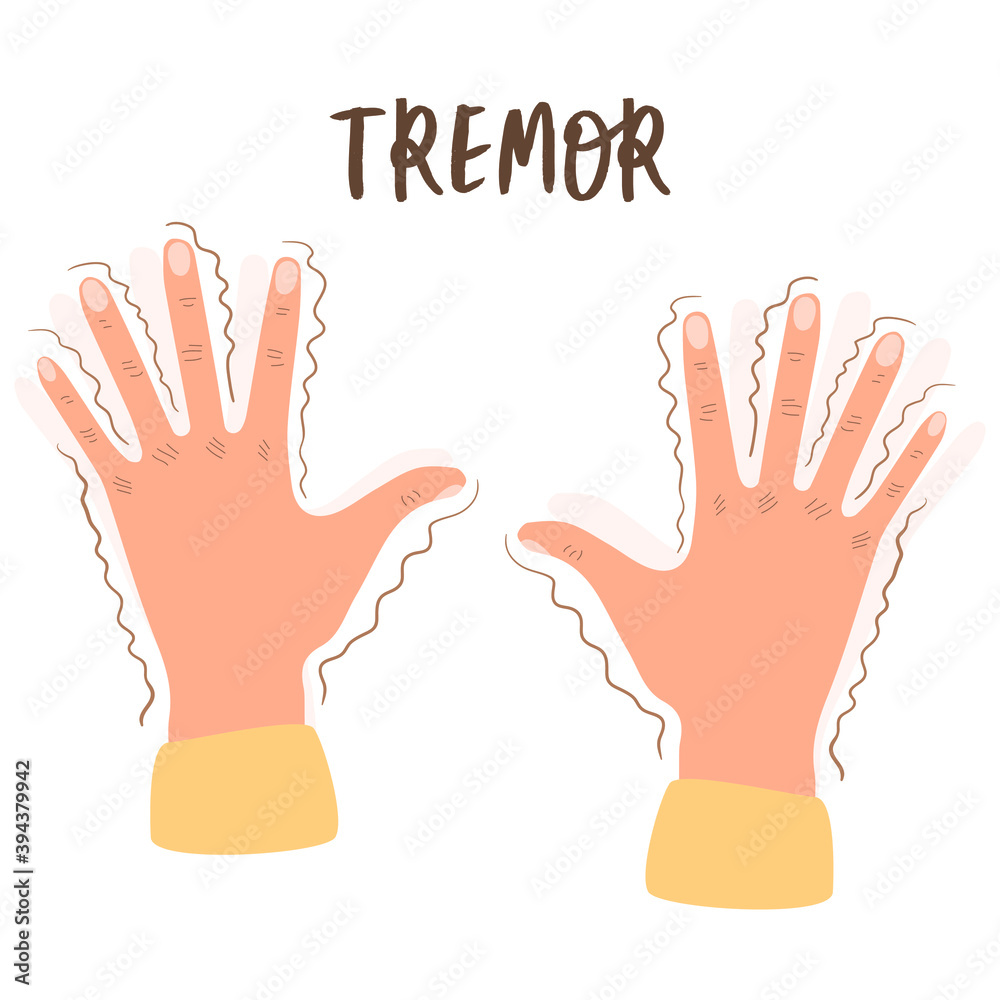 Flat vector illustration of a tremor. Trembling in the hands-symptoms ...