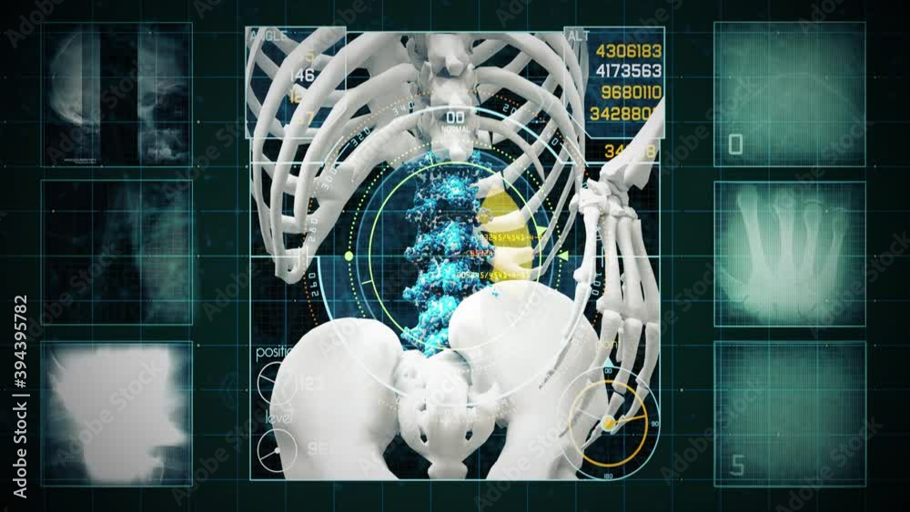 Digital graphic scan human spine focus trigger point and have particle relieve painful in ...