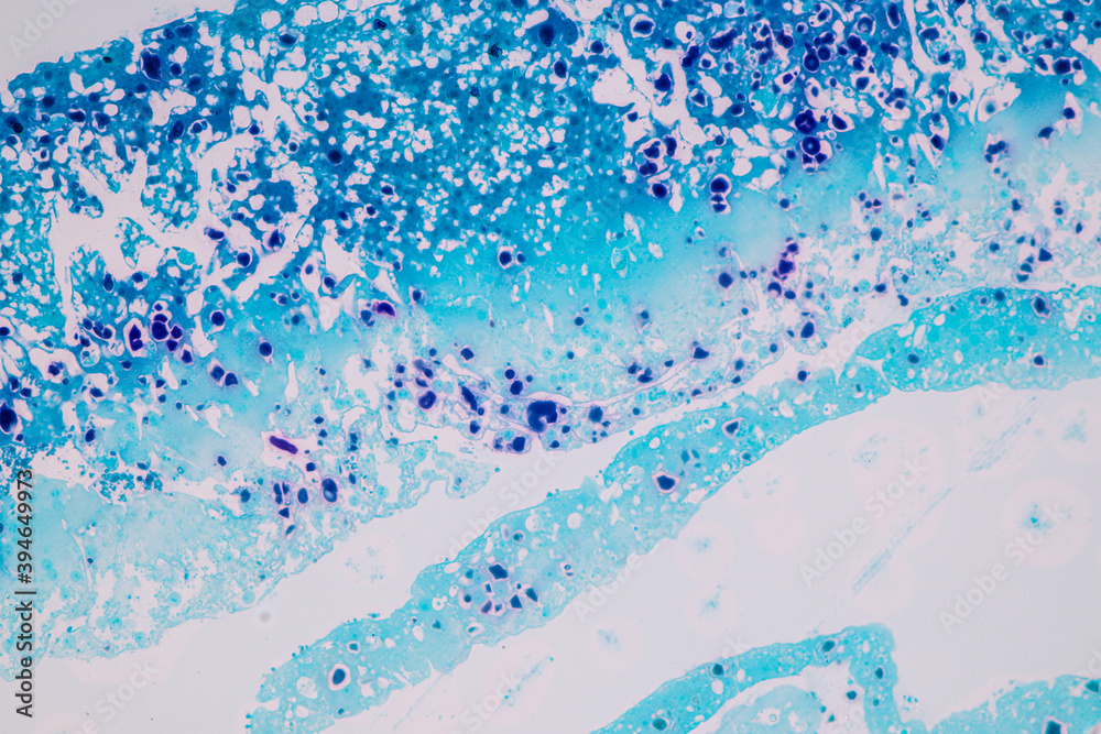 Slime molds, as a group, are polyphyletic under the microscope for ...