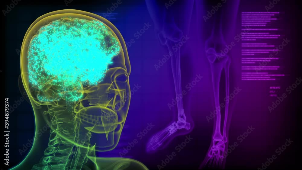 Brain neural impulses affect body systems concept - anatomy x-ray human ...