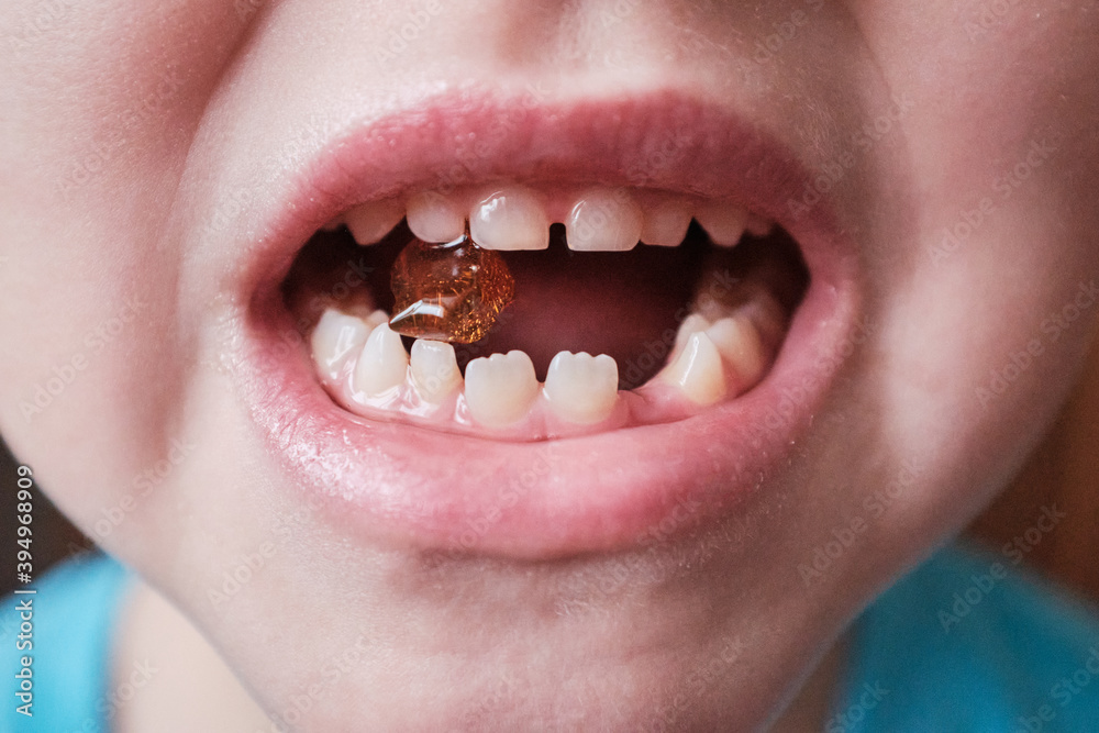 large mouth of a child without a tooth. First fallen tooth. The tooth ...