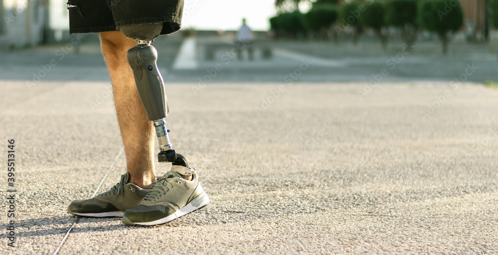 Low angle view at disabled young man with prosthetic leg walking along ...
