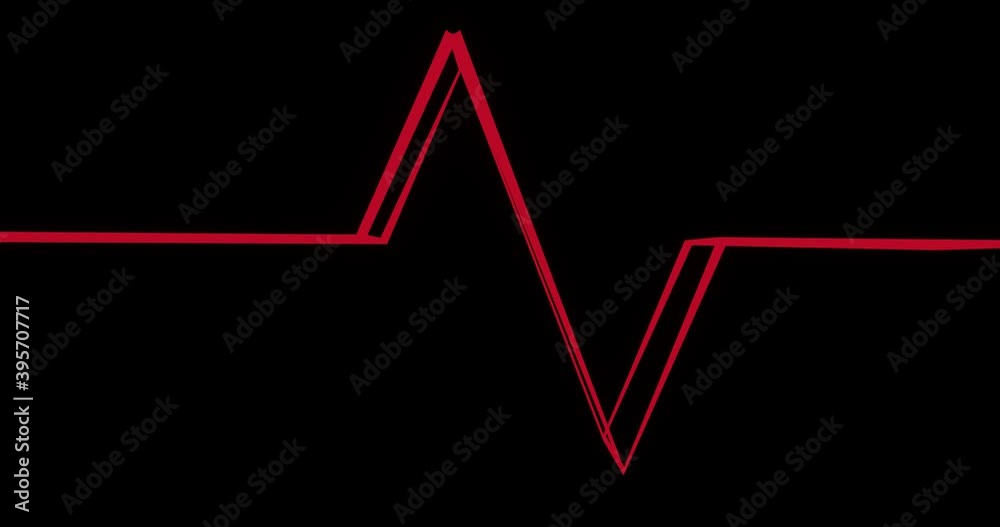 Red Blood pulse sign animation design with stylized emission. Emergency ...