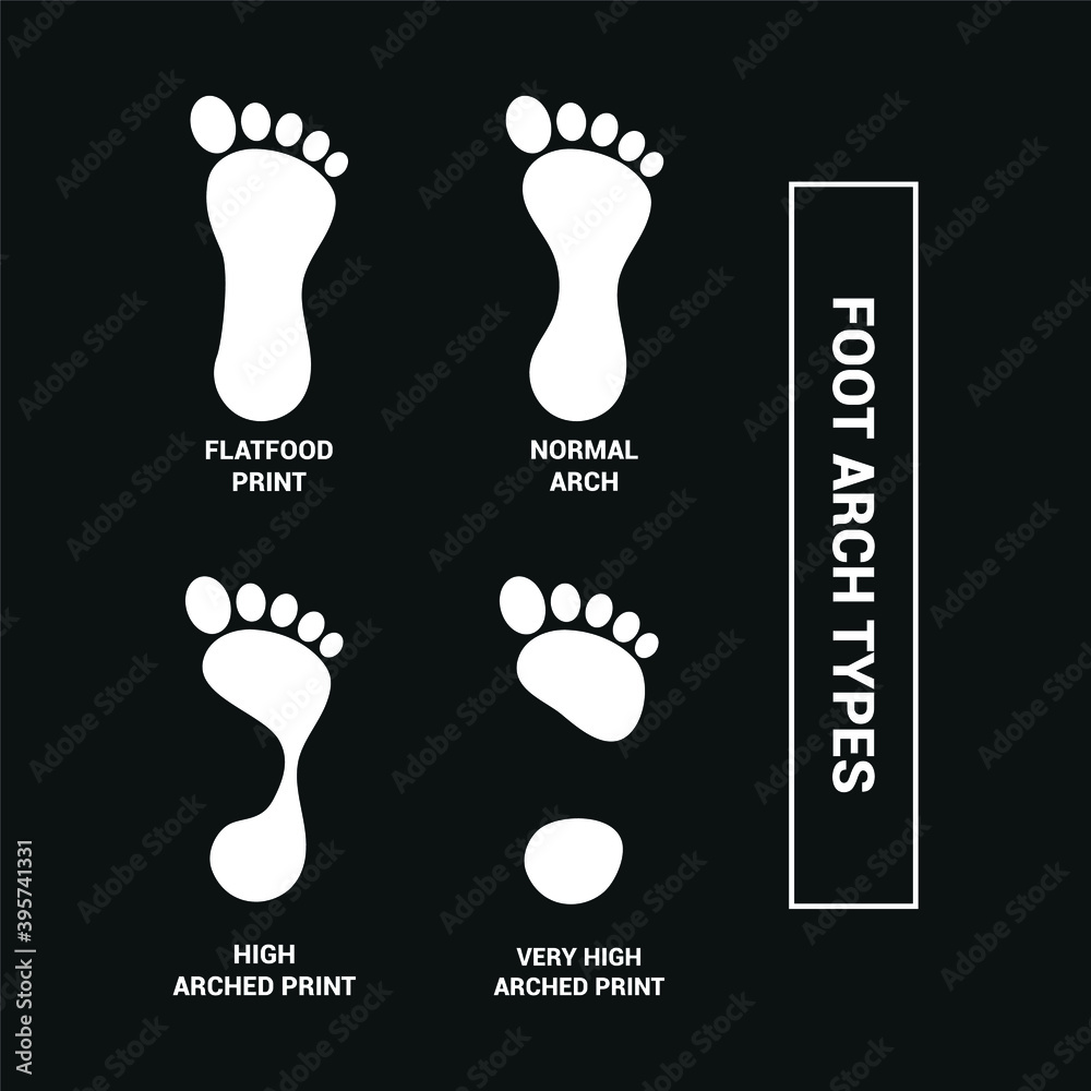 Vector image. Feet icons. Image of ways of footprint. Stock Vector ...