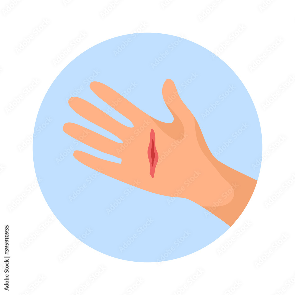 Cut injury with red blood on palm in flat design. Wound on hand concept ...
