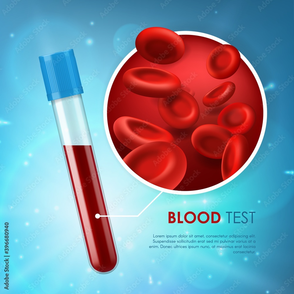 Blood test vector medicine poster with 3d red cells and blood in glass ...