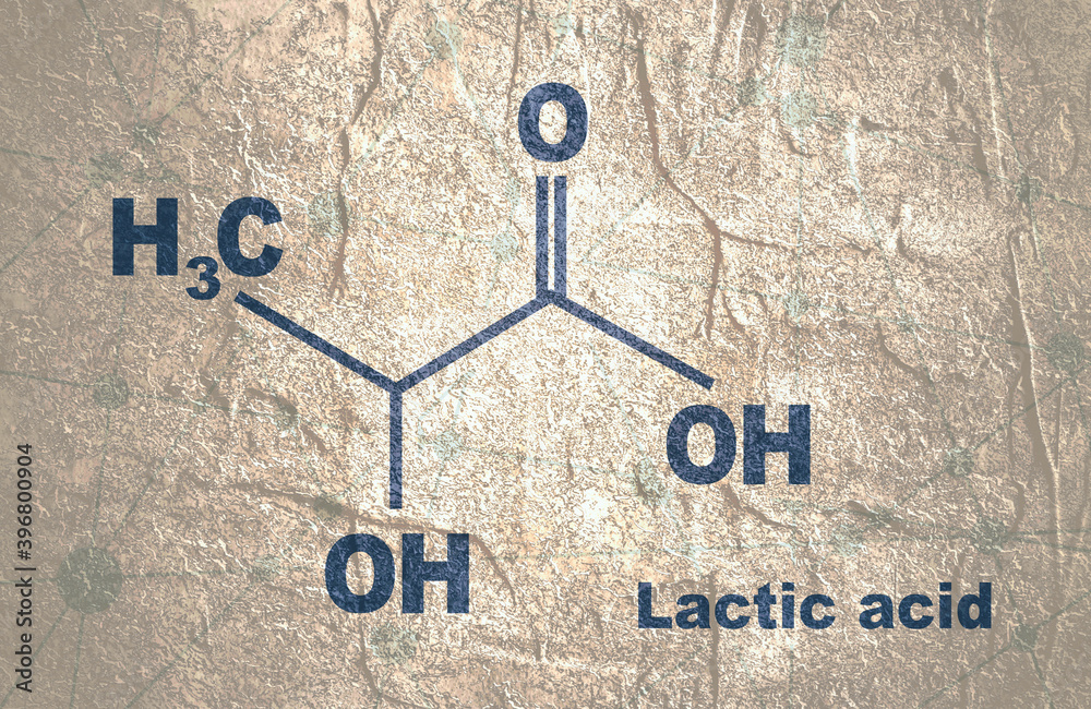 Lactic acid molecule. Structural chemical formula. Infographics ...