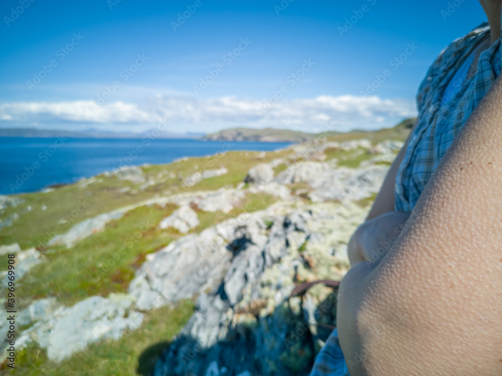 Human skin with goosebumps from the cold Stock Photo | Adobe Stock