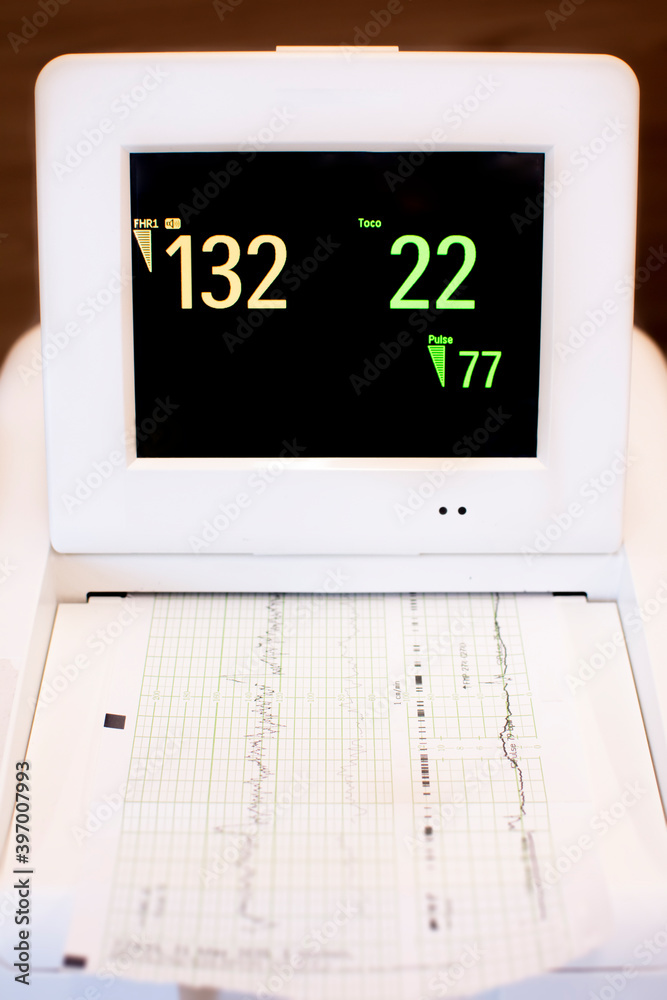 Fetal monitor for non stress test(NST) printing the baby's heart beats ...
