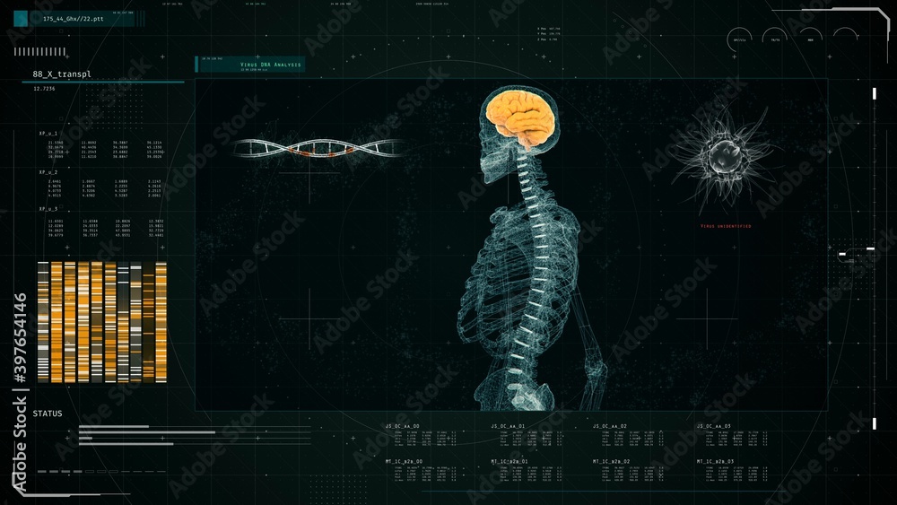 Patient's brain scan on screen, DNA research, genetic disorder ...