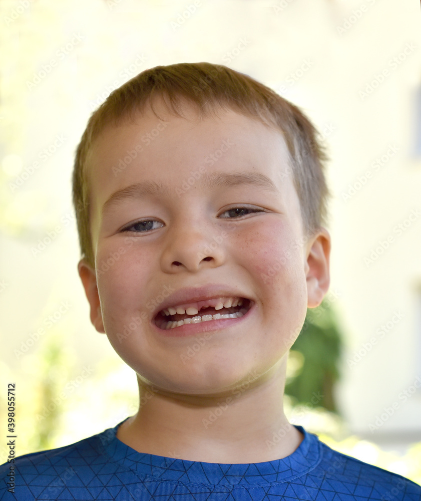 Little boy smiling without one tooth. Portrait of a laughing toothless ...