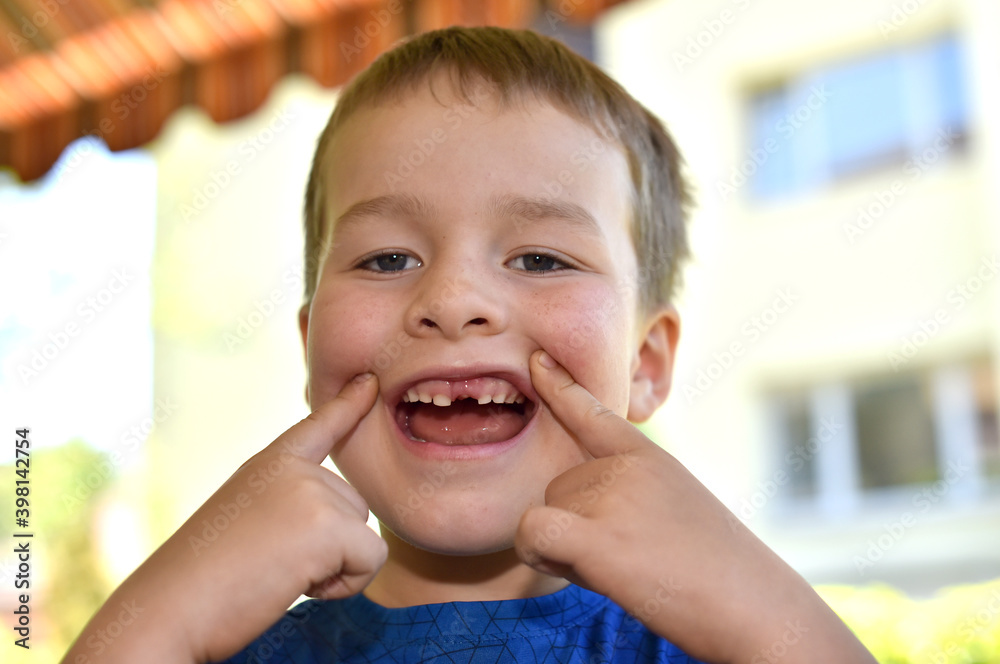 Little boy smiling without one tooth. Portrait of a laughing toothless ...