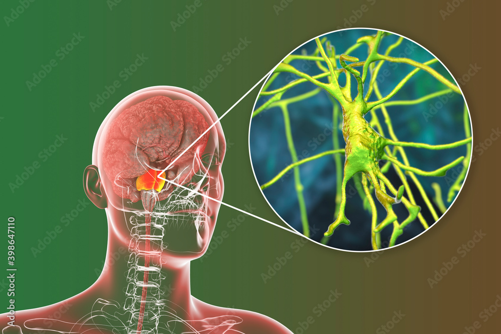 Neurons, brain cells, located in the pons Varolii of the human brain ...