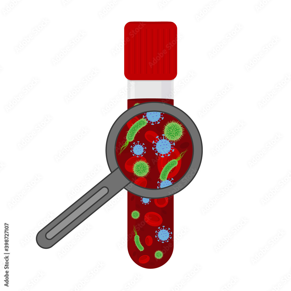 Blood with infection in a test tube under a magnifying glass, color ...