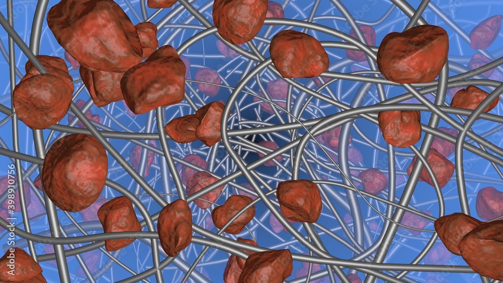 Dirt captured in fibers. Particles separated and captured in filter ...