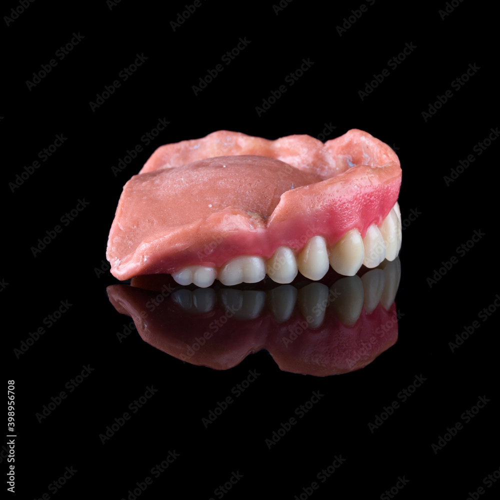 Complete maxillary denture – Wax-Up and Gingival Contouring Stock Photo ...