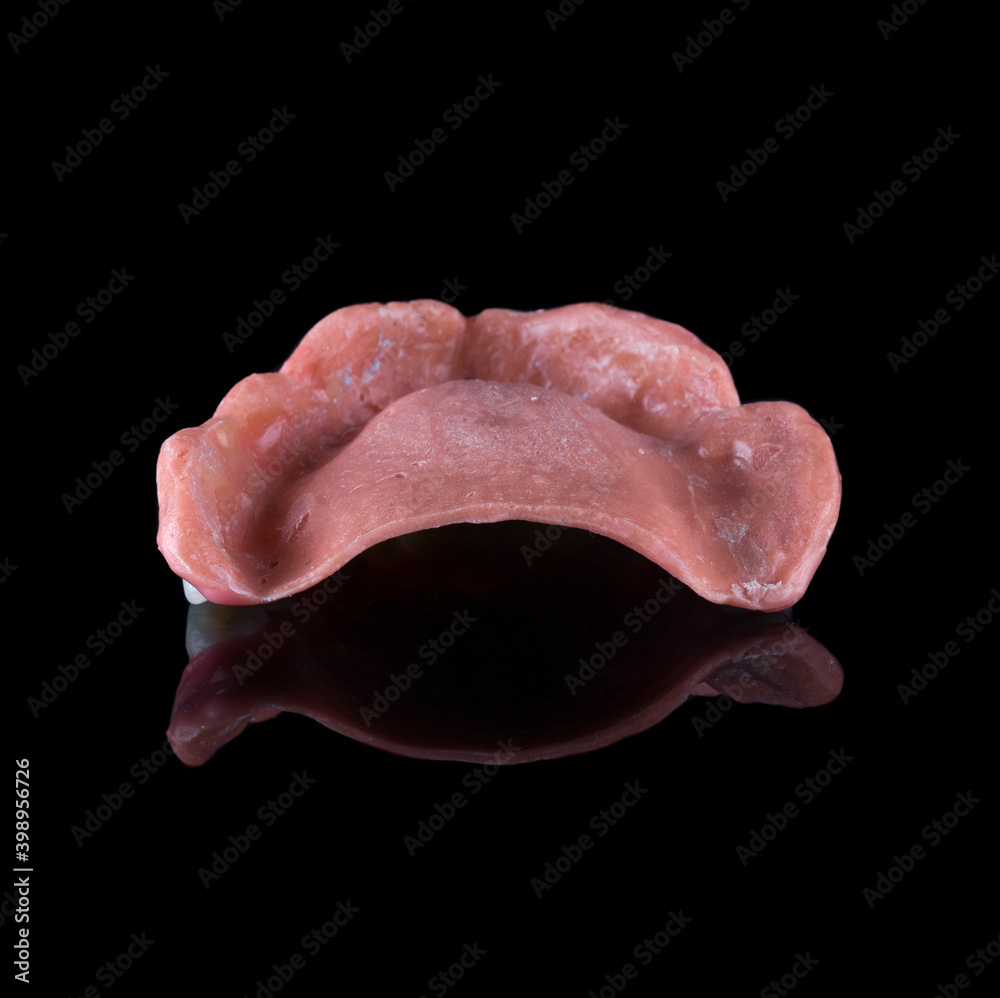 Complete maxillary denture – Wax-Up and Gingival Contouring Stock Photo ...