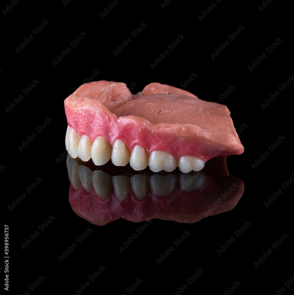 Complete maxillary denture – Wax-Up and Gingival Contouring Stock Photo ...
