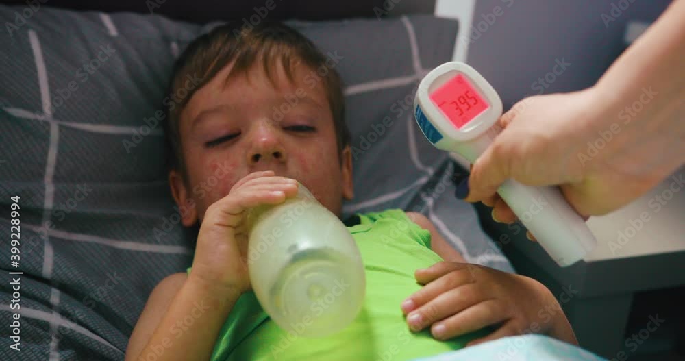 Video „Viral disease. Measles rash. Child with viral infection measles ...