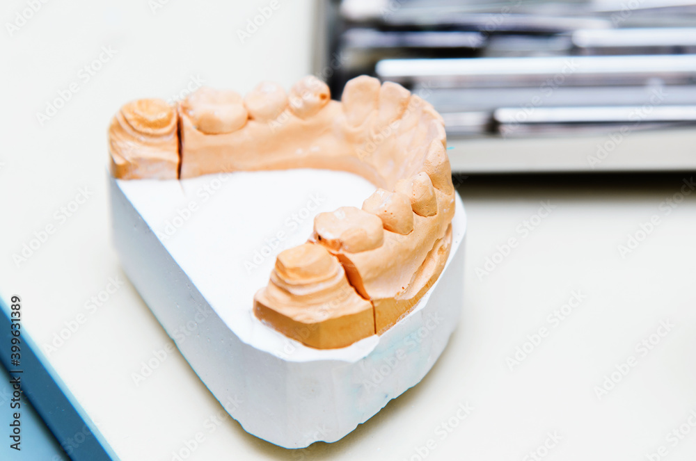 Impression of the jaw plaster model of the human oral cavity, dentistry ...