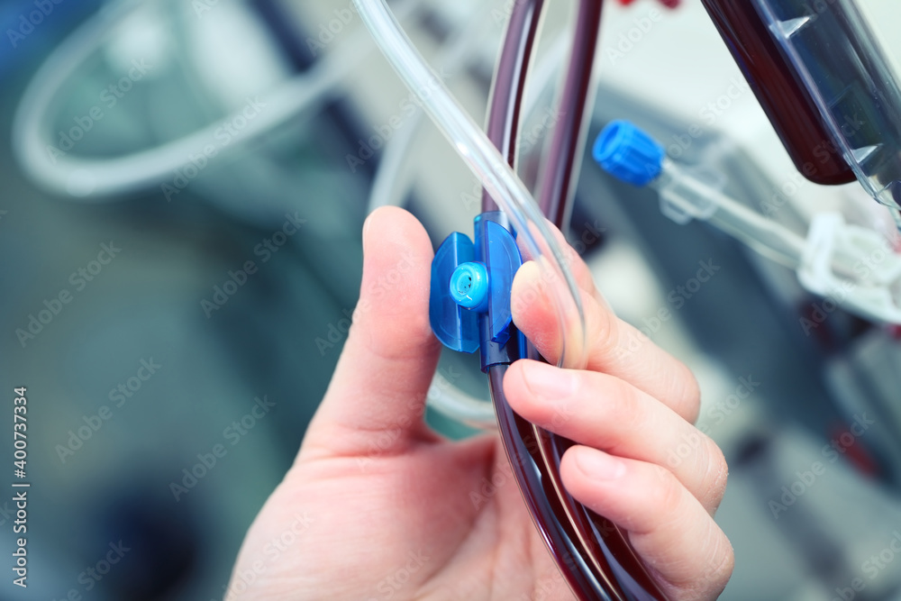 Hemodialysis tubes filled with filtering blood are held by the doctor's ...