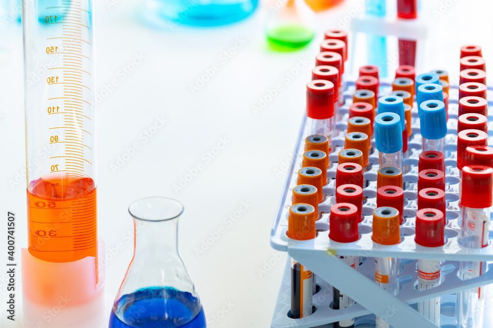 Laboratory background with blood samples rack and glassware with ...