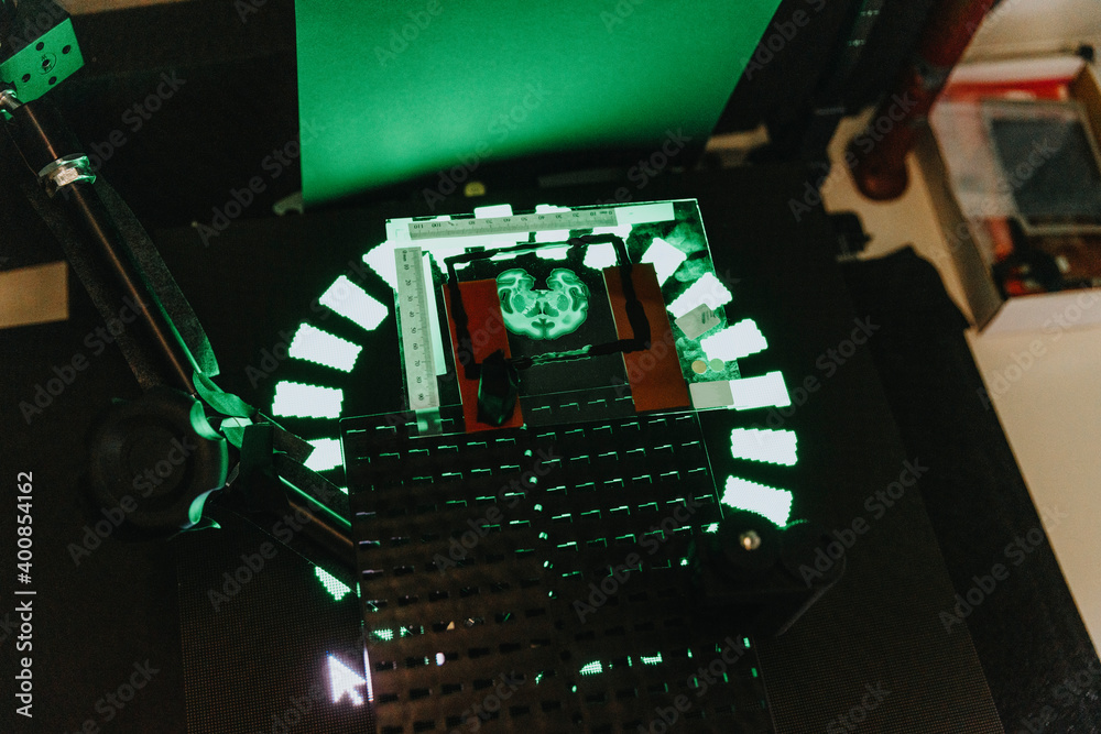 Human brain slide on illuminated microscope at laboratory Stock Photo ...
