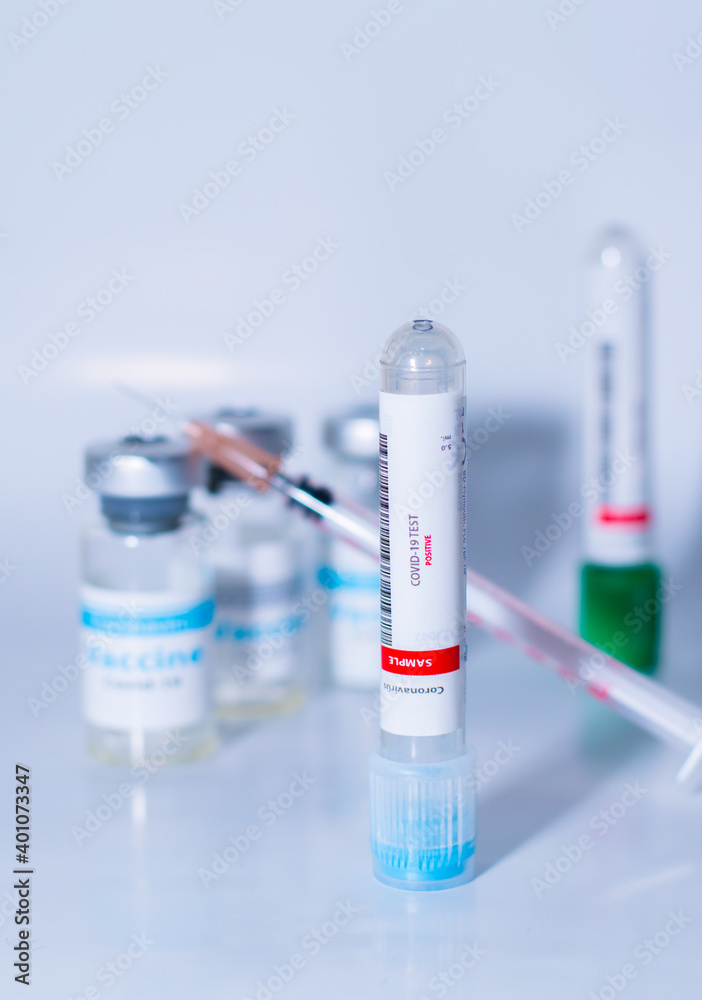 Testing for presence of coronavirus. Tube containing a swab sample that ...