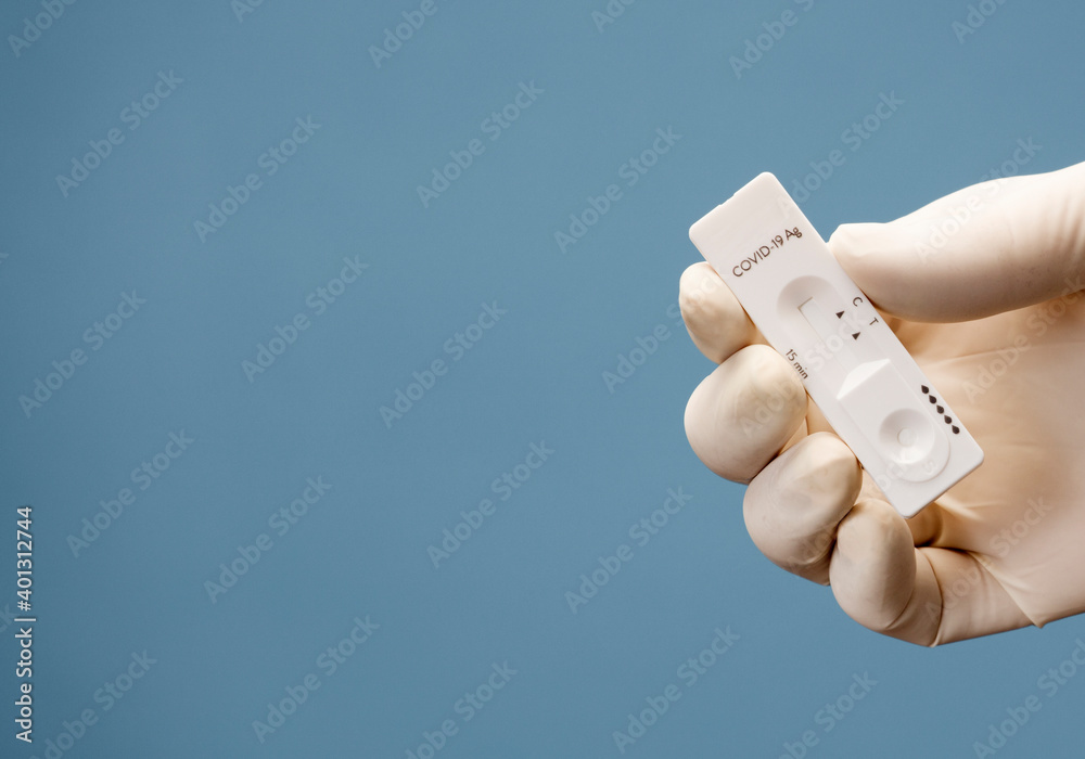 Rapid COVID-19 test. Serological detection of IgM and IgG antibodies ...