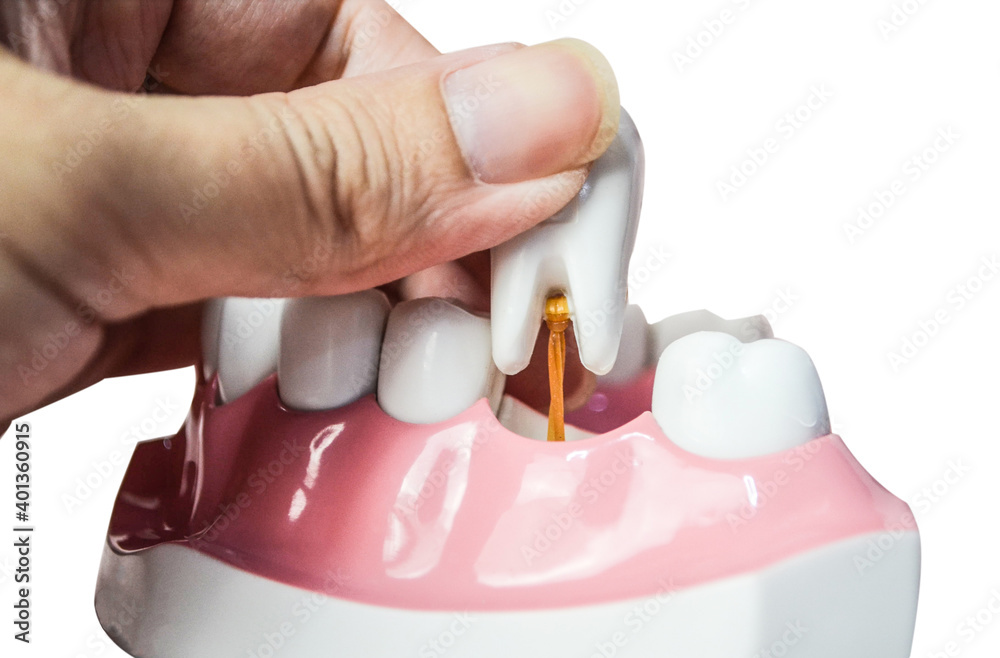 Hand extracting a tooth model,Hand pulling out a tooth model.Hand ...
