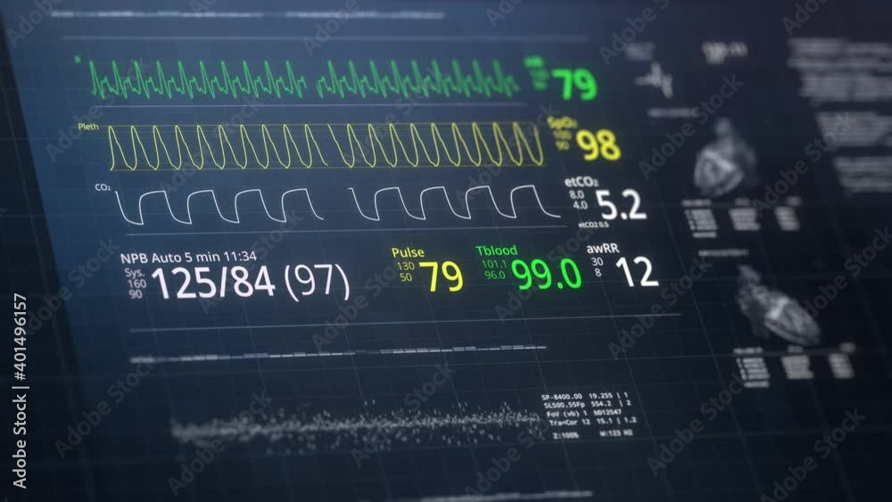 Heart scanning, patient vital life signs such as heart rate, blood ...
