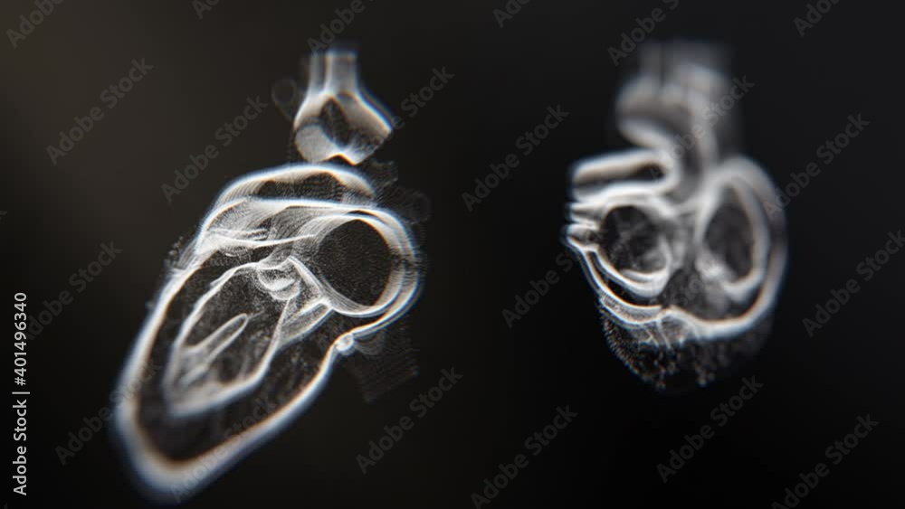 Heart scanning animation. X-ray monitoring concept. Hi-tech MRI device ...