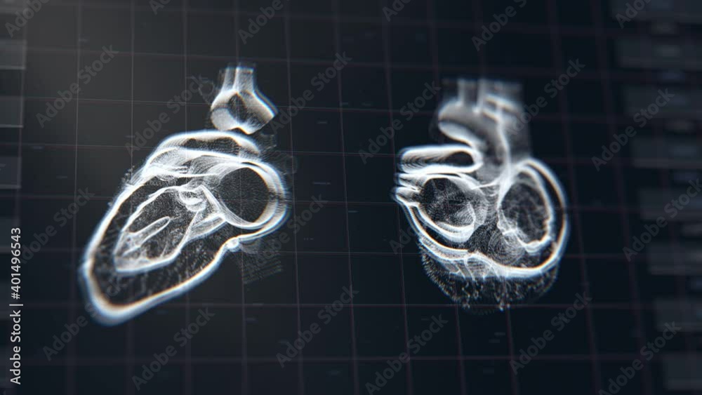 Futuristic heart scanning animation. Hi-tech MRI device. Diagnosis data ...