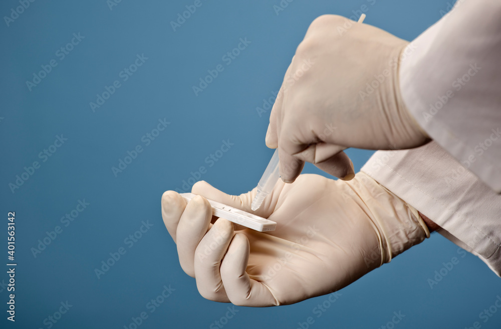 Laboratory Scientist Performing RDT Rapid Diagnostic Test For ...