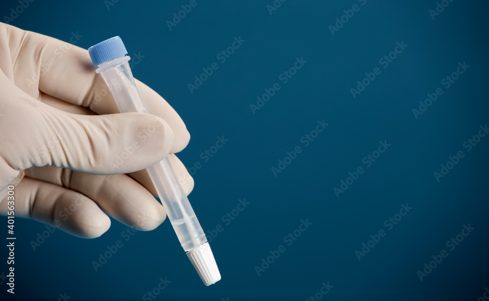 Laboratory scientist with vial and swab indoors performing a rapid ...
