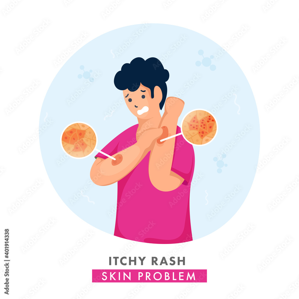 Cartoon Young Boy Itching His Hands And Showing Skin Rashes on White ...