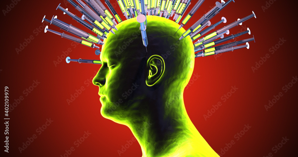 Adult Male Infected By Virus And Transforming To A Zombie. Patient ...