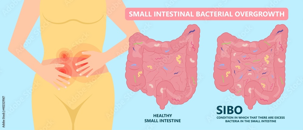 intestine bacteria gut pain eating IBS large fungal fungi tract H ...