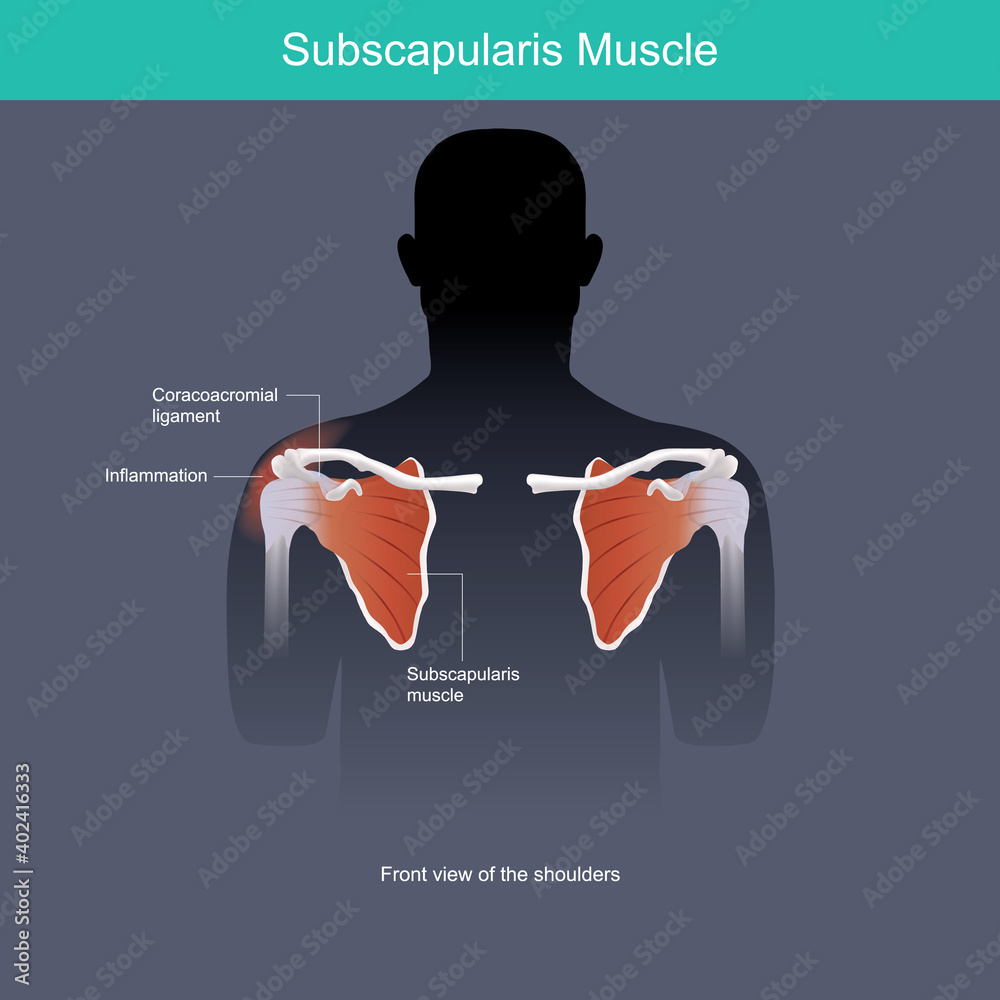 Subscapularis Muscle. Illustration for medical use explain the ...
