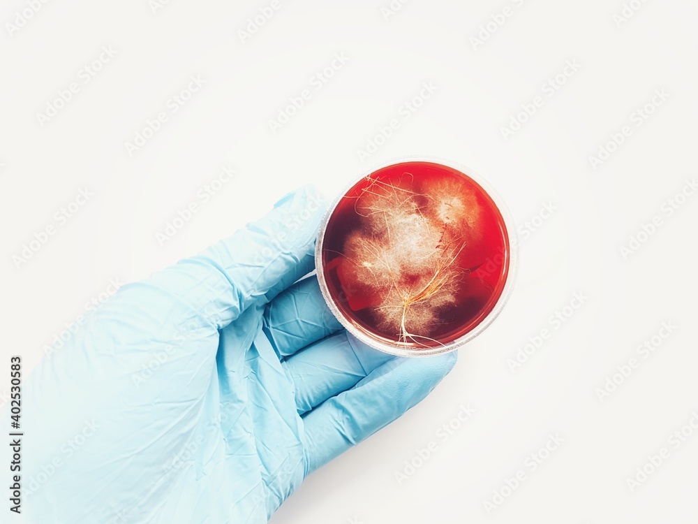 A dermatophyte test medium (DTM) culture in Petri dish using for growth ...