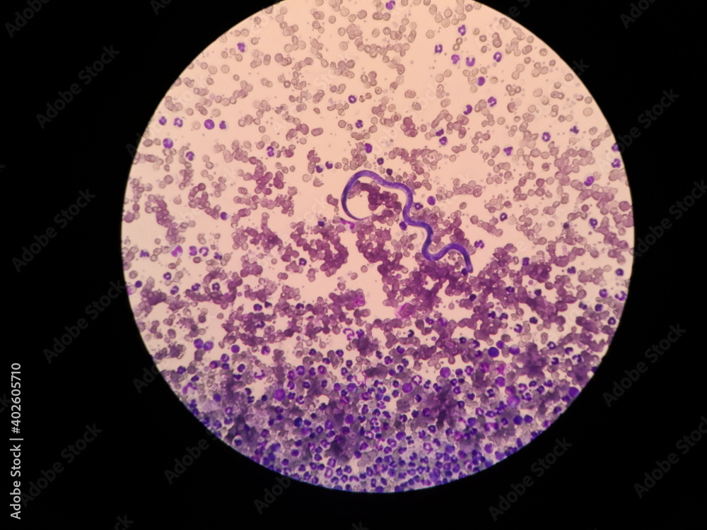 Microfilariae are not sheathed in the blood smear of a dog. Light ...