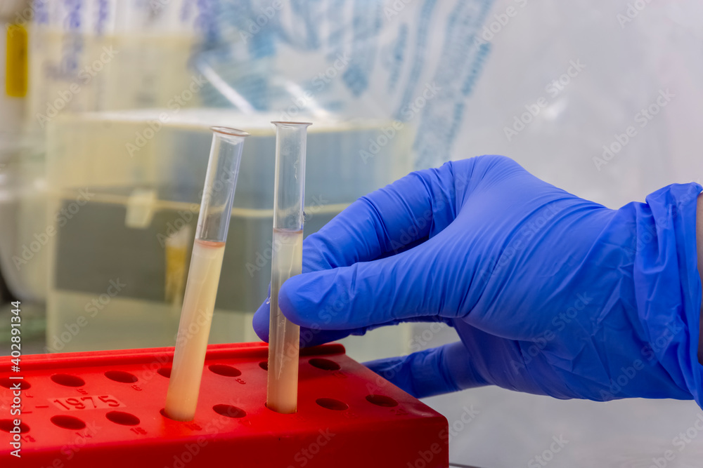 Scientist wearing gloves doing experiment with bacterial sample in the ...
