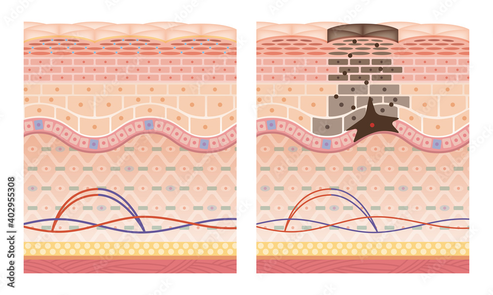 Cross section of the skin 9 front No commentary Stock Vector | Adobe Stock